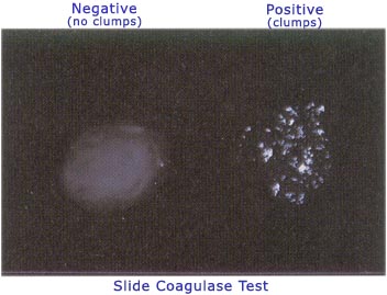 Coagulase Test- Principle, Procedure, Types, Interpretation and Examples