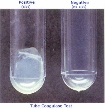 Coagulase Test- Principle, Procedure, Types, Interpretation and Examples