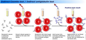 Coombs Test- Principle, Types, Procedure and Result Interpretation
