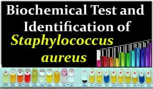Biochemical Test and Identification of Staphylococcus aureus