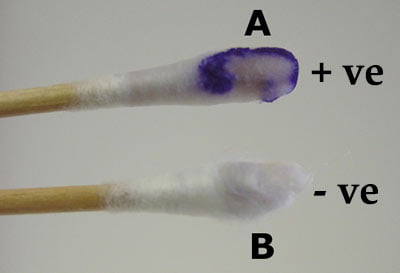 Oxidase Test- Principle, Uses, Procedure, Types, Result Interpretation...