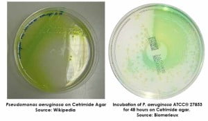 Cetrimide Agar- Composition, Principle, Uses, Preparation and Colony ...