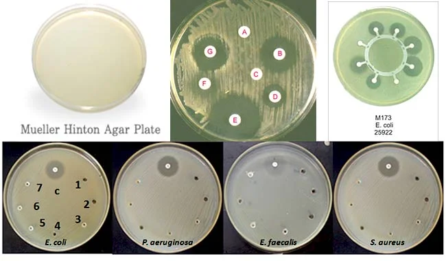 Mueller Hinton Agar (MHA) – Composition, Principle, Uses and Preparation