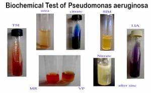 Biochemical Test of Bacteria