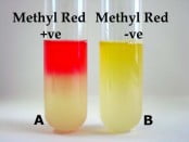 Methyl Red (MR) Test- Principle, Procedure and Result Interpretation