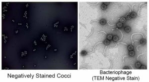 Negative Staining- Principle, Reagents, Procedure and Result