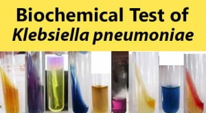 Biochemical Test and Identification of Klebsiella pneumoniae ...