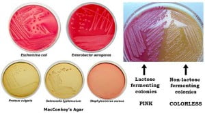 MacConkey Agar- Composition, Principle, Uses, Preparation and Colony ...