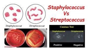 Differences Between Staphylococcus and Streptococcus - Microbiology ...