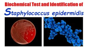Biochemical Test and Identification of Staphylococcus epidermidis