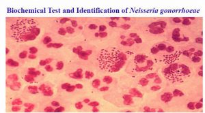 Biochemical Test of Bacteria