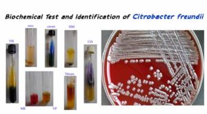 Biochemical Test and Identification of Citrobacter freundii