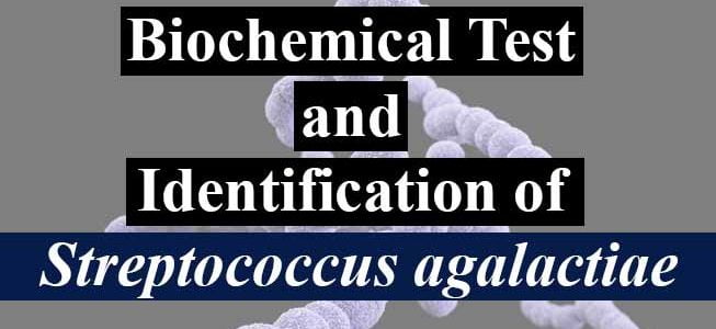 Biochemical Test and Identification of Streptococcus agalactiae