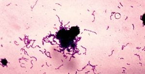 Biochemical Test and Identification of Streptococcus mutans