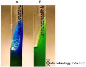 Acetate Utilization Test - Principle, Procedure, Uses and Interpretation