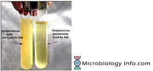 Bile Solubility Test- Principle, Reagents, Procedure and Result ...