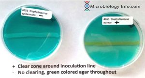 Deoxyribonuclease (DNase) Test - Procedure, Uses and Interpretation