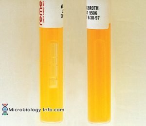 MRS Broth Test - Principle, Procedure, Uses and Interpretation