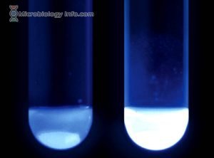 MUG test - Principle, Procedure, Uses and Interpretation