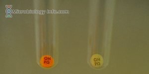 ONPG Test - Principle, Procedure, Uses and Interpretation