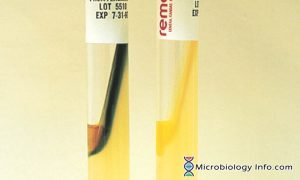 Phenylalanine Agar Test - Principle, Procedure, Uses and Interpretation