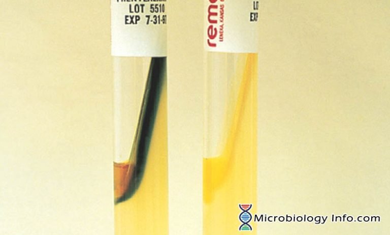 Phenylalanine Agar Test - Principle, Procedure, Uses and Interpretation