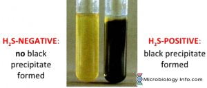 Sulphur Reduction Test - Principle, Procedure, Uses and Interpretation