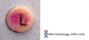 Leucine amino peptidase (LAP) Test - Procedure, Uses and Interpretation