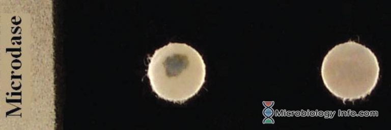 Microdase Test - Principle, Procedure, Uses and Interpretation