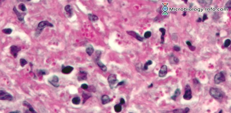 Mycology Archives - Microbiology Info.com